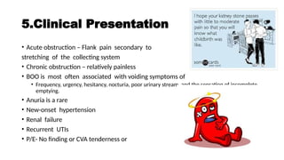 Upper Urinary Tract Obstruction (1).pptx