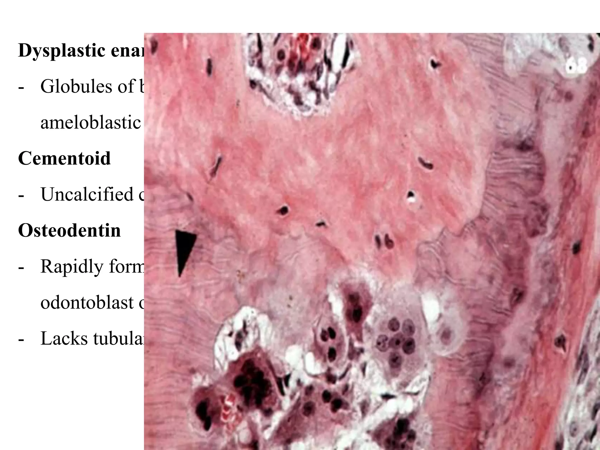 mixed odontogenic tumors | PPTX
