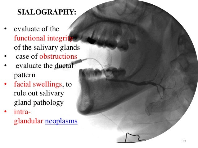 salivary glands