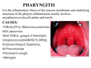 UPPER RESPIRATORY TRACK INFECTION ,CAUSES, AND MEDICAL ,NURSING ...