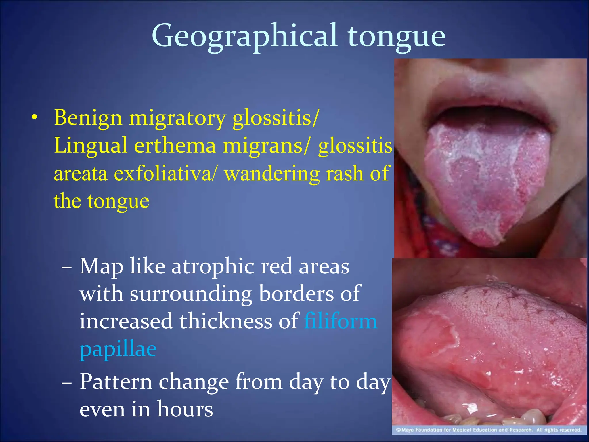 Oral_cavity_ulcers in otolaryngology .ppt