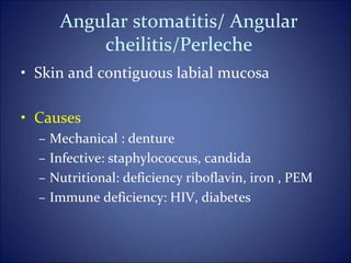 Oral_cavity_ulcers in otolaryngology .ppt
