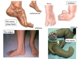 Upper and Lower Limbs Clinically Oriented Anatomy | PPT