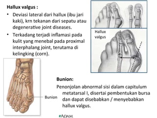 Upper and Lower Limbs Clinically Oriented Anatomy | PPT