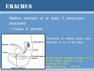 URACHAL MASSES. Dr Saneej | PPTX