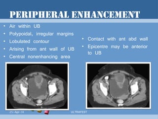 URACHAL MASSES. Dr Saneej | PPTX