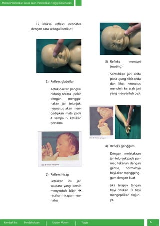 Pemeriksaan Fisik pada Neonatus | PDF