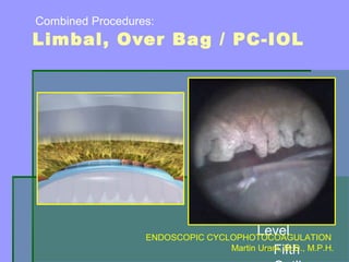 Uram ecp course | PPT