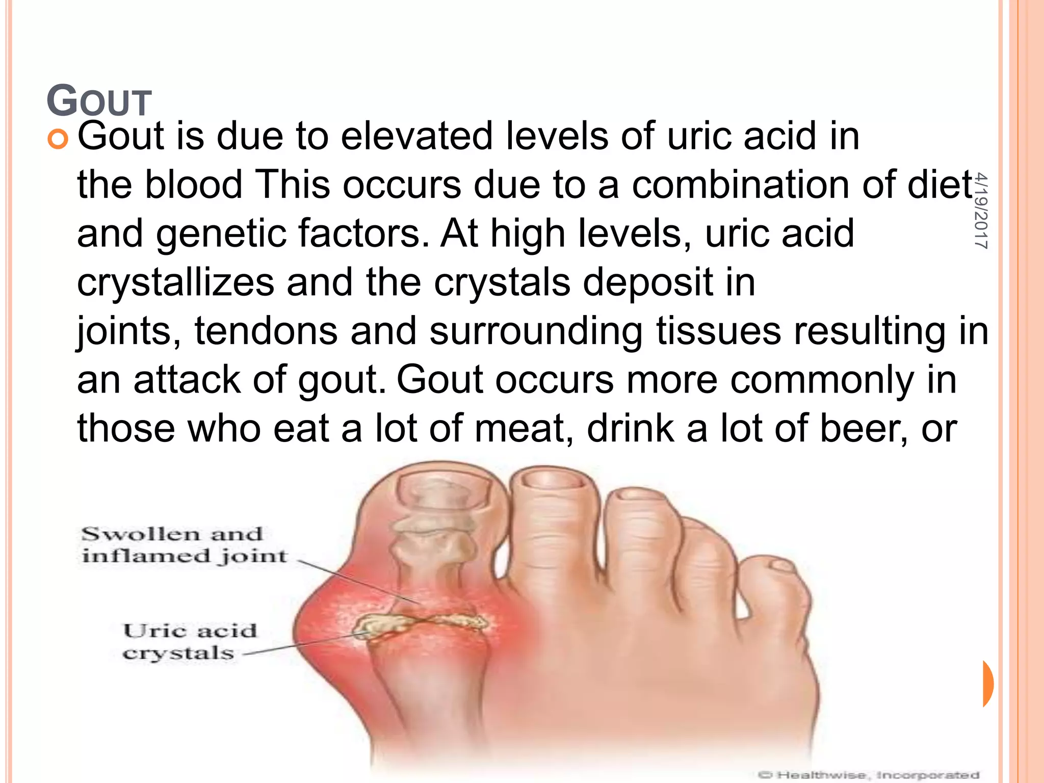 Urea and Uric acid | PPTX