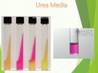 Urea media | PPTX