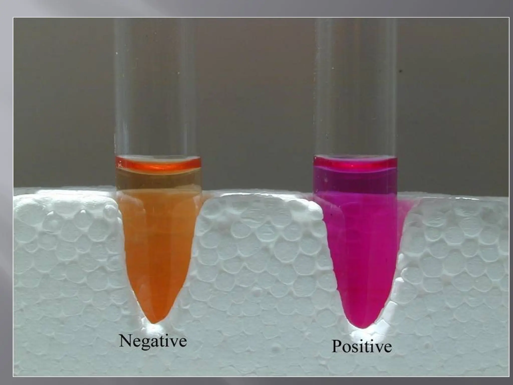 Urease Test.pptx microbiology hematology | PPTX