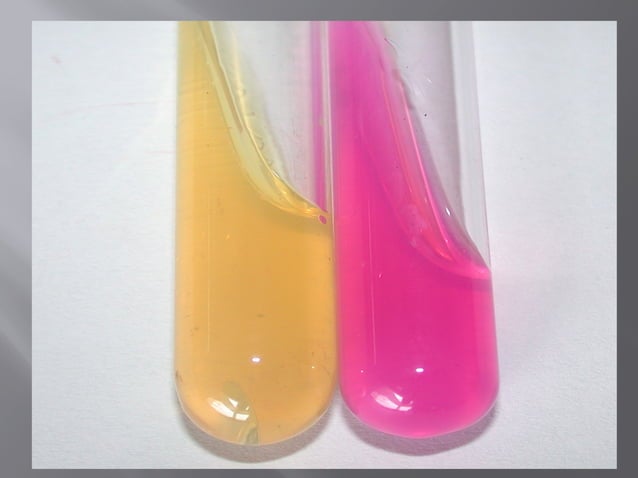 Urease Test.pptx microbiology hematology | PPTX | Infectious Diseases ...