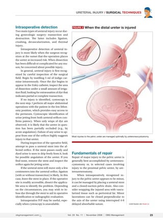 Ureter | PDF