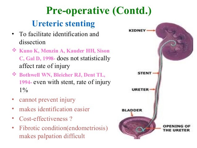 Ureteric Injury at Gynaecological Surgery
