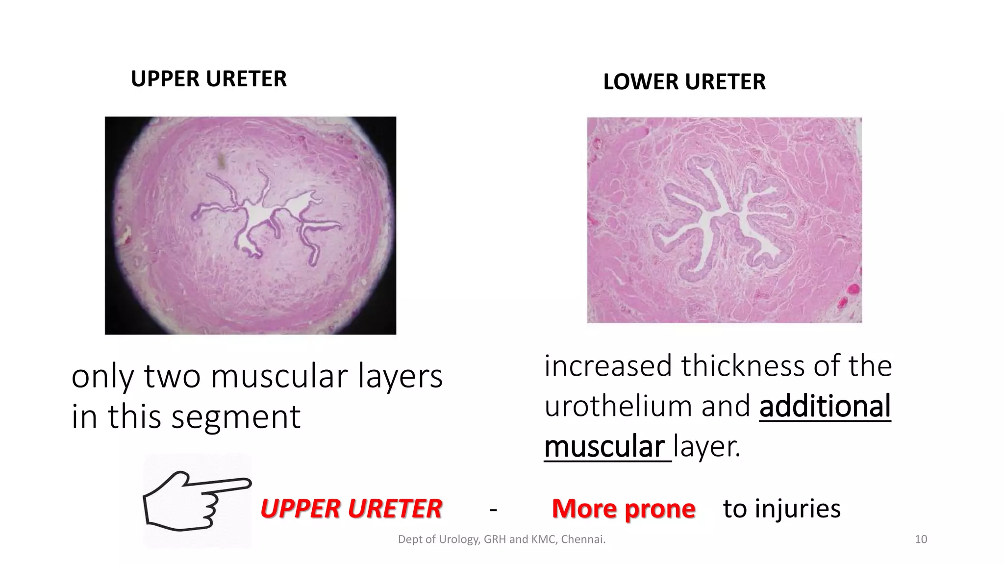 URETER - ANATOMY, PHYSIOLOGY, EMBRYOLOGY | PDF