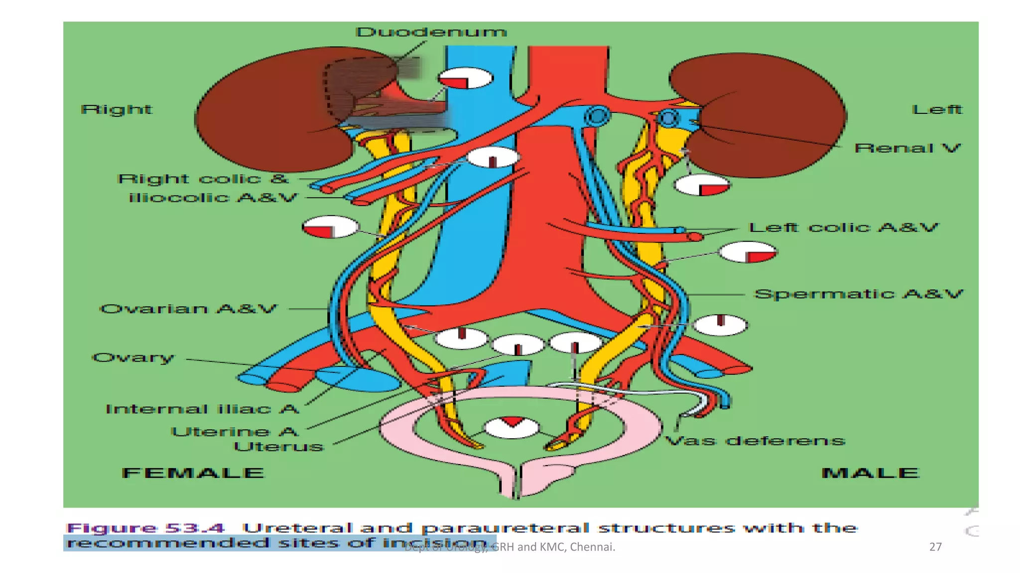 URETER - ANATOMY, PHYSIOLOGY, EMBRYOLOGY | PDF