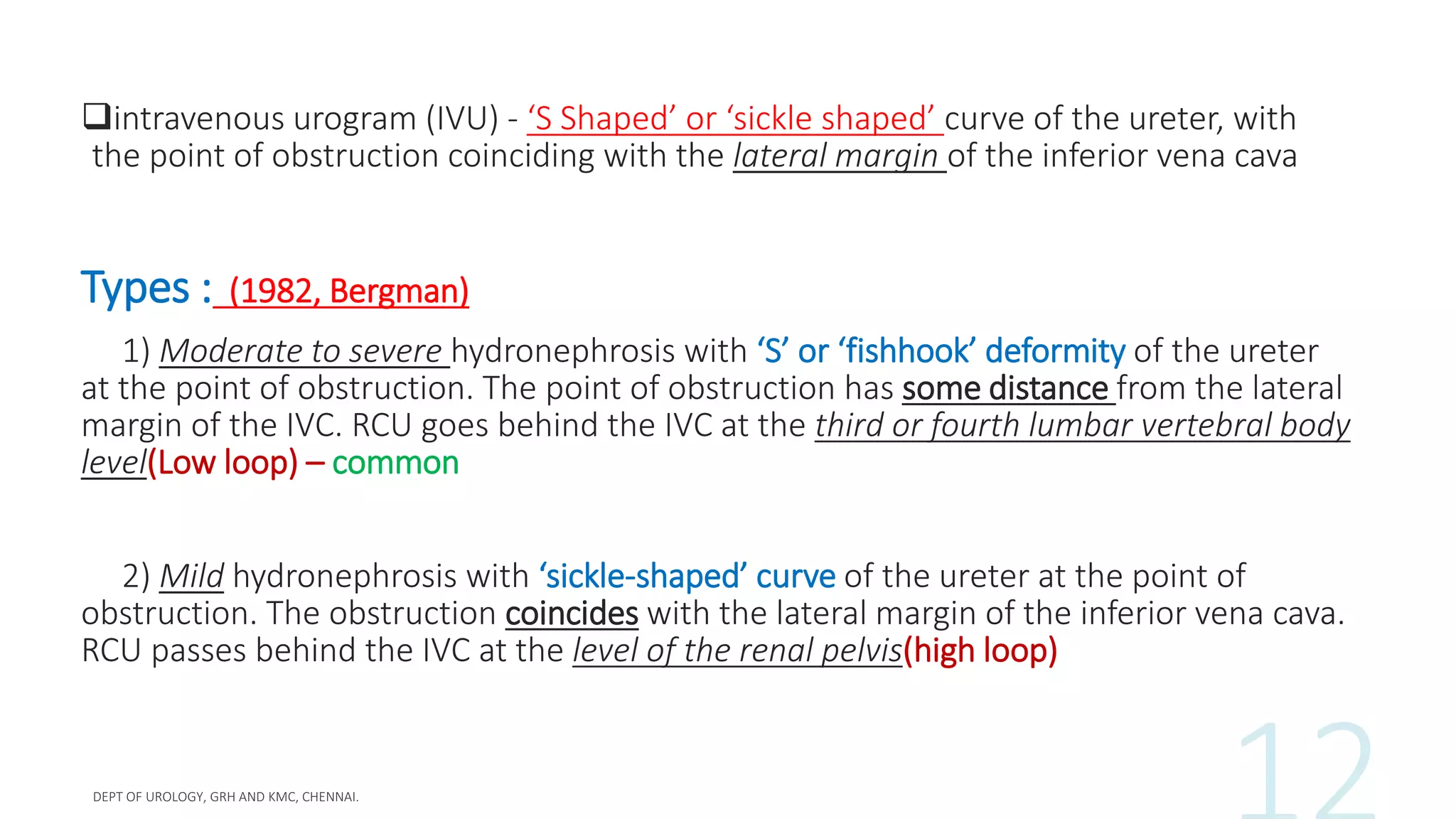 retrocaval ureter | PDF