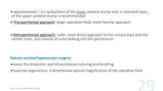 retrocaval ureter | PDF