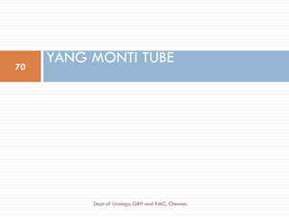 Ureter stricture- management | PDF
