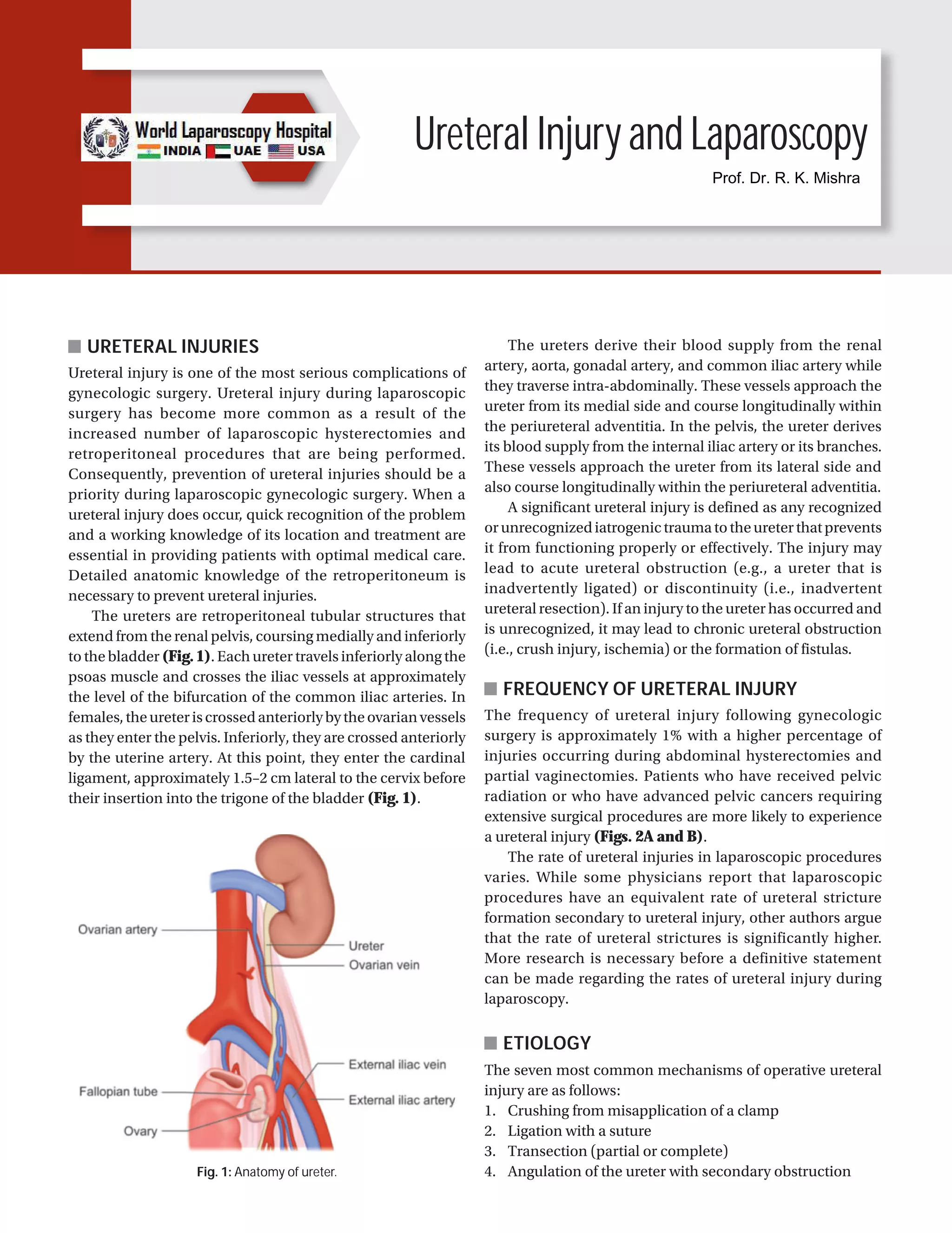 Ureteral Injury and Laparoscopy | PDF
