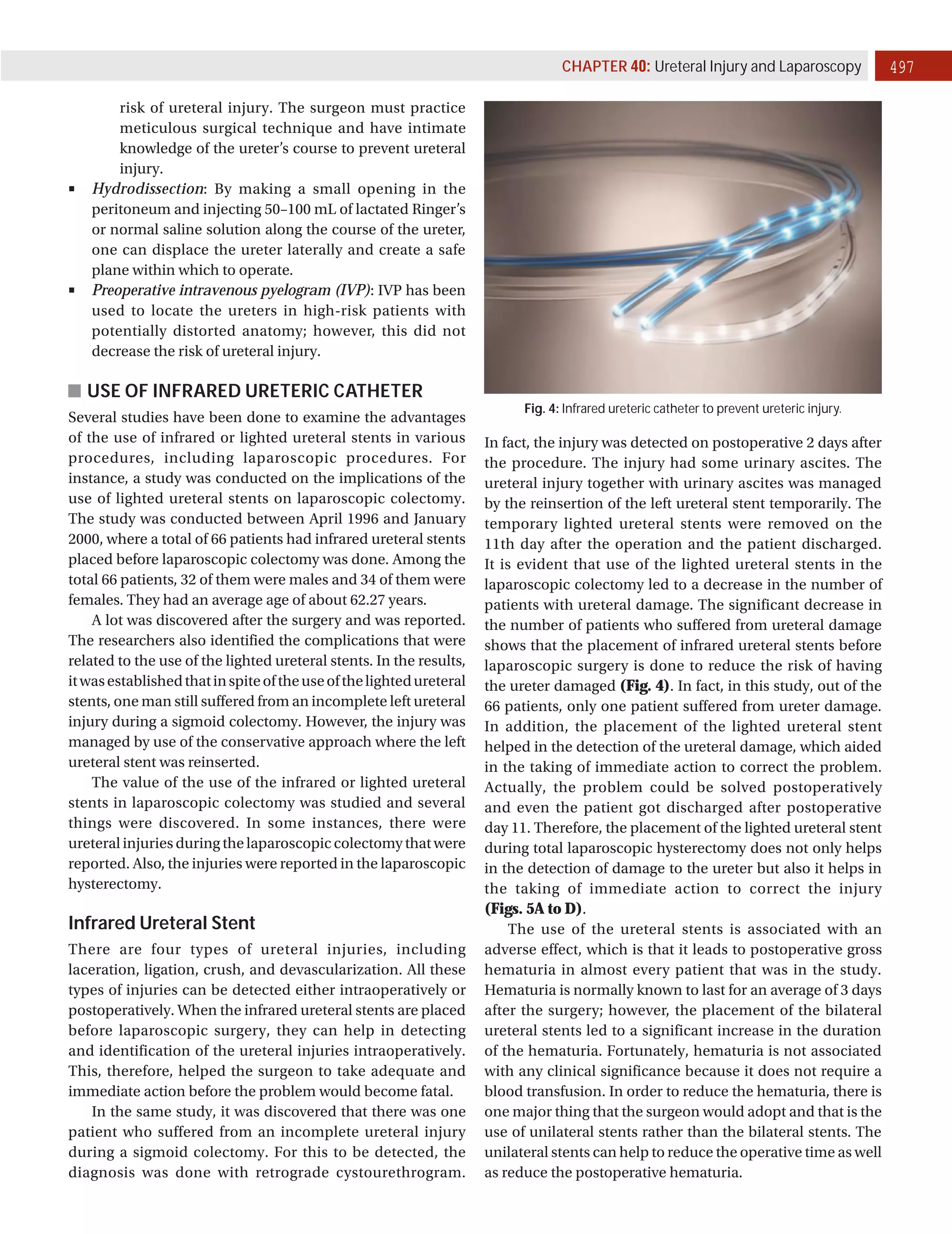 Ureteral Injury and Laparoscopy | PDF