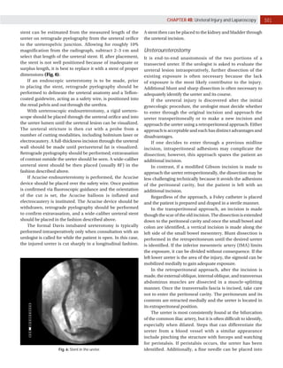 Ureteral Injury and Laparoscopy | PDF