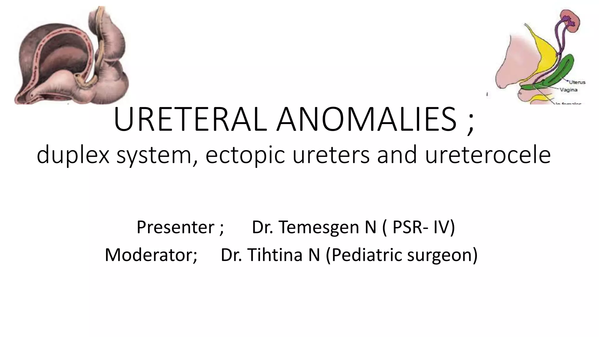 Ureteral Anomalies Pptx