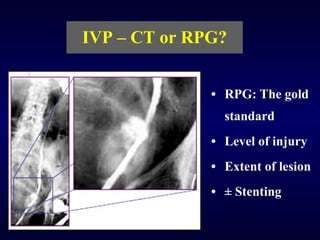 Ureteral Injury in gyne and obstetri.ppt