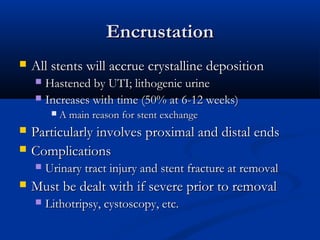 Ureteral stents for the Dx Radiologist | PPT