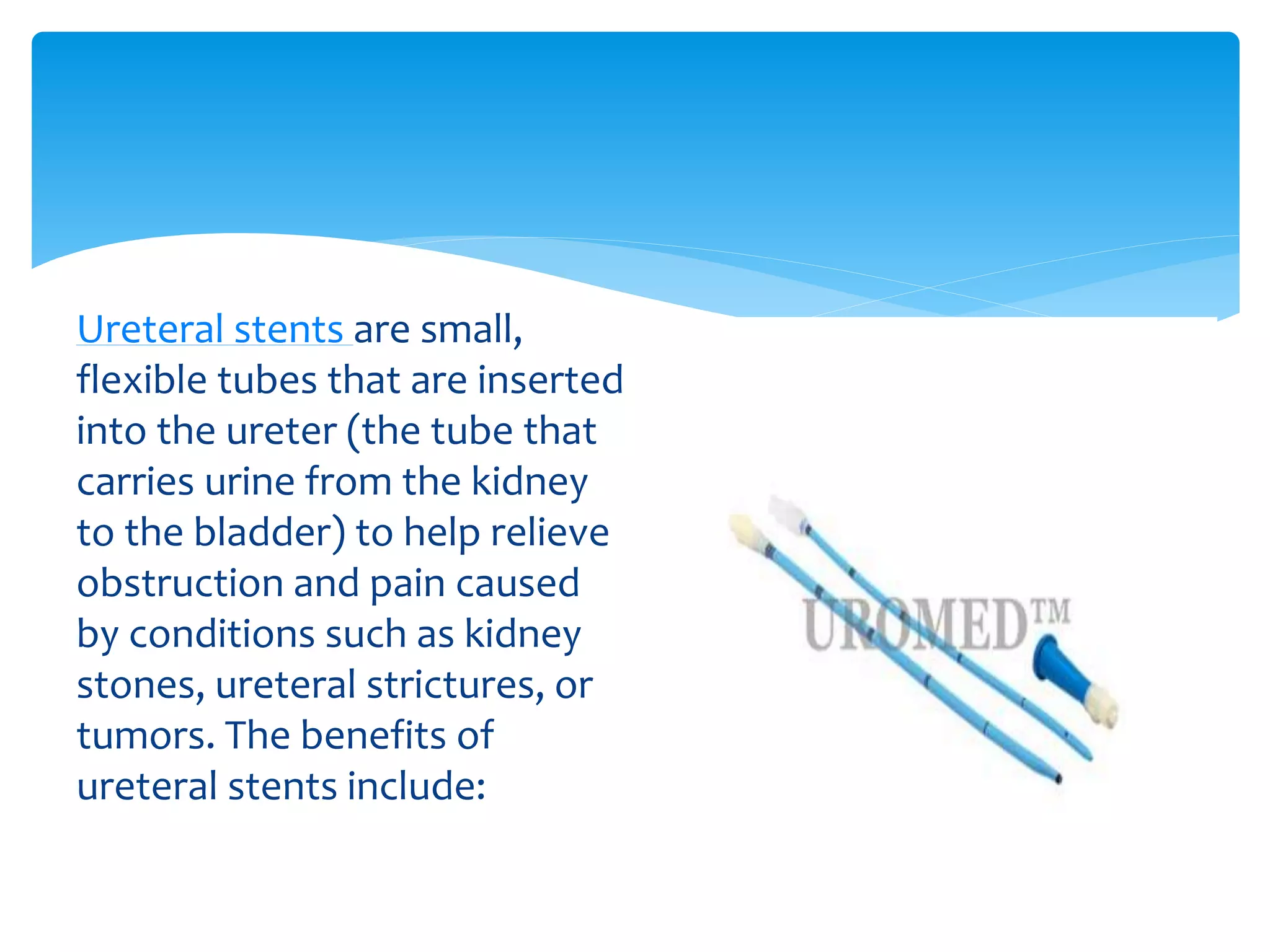 ureteral stents | PPTX