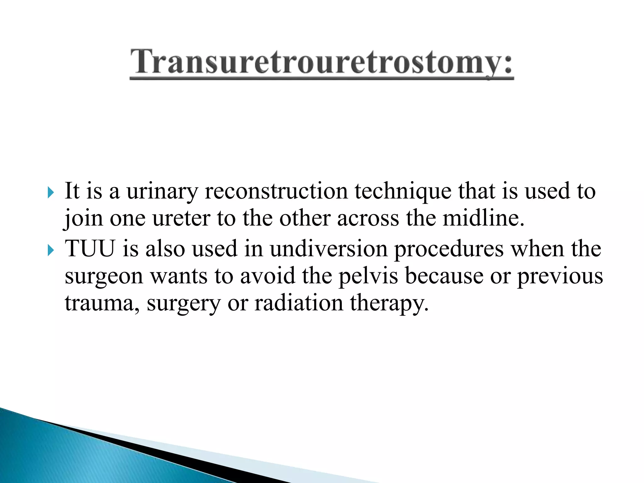 Ureteral stricture | PPTX