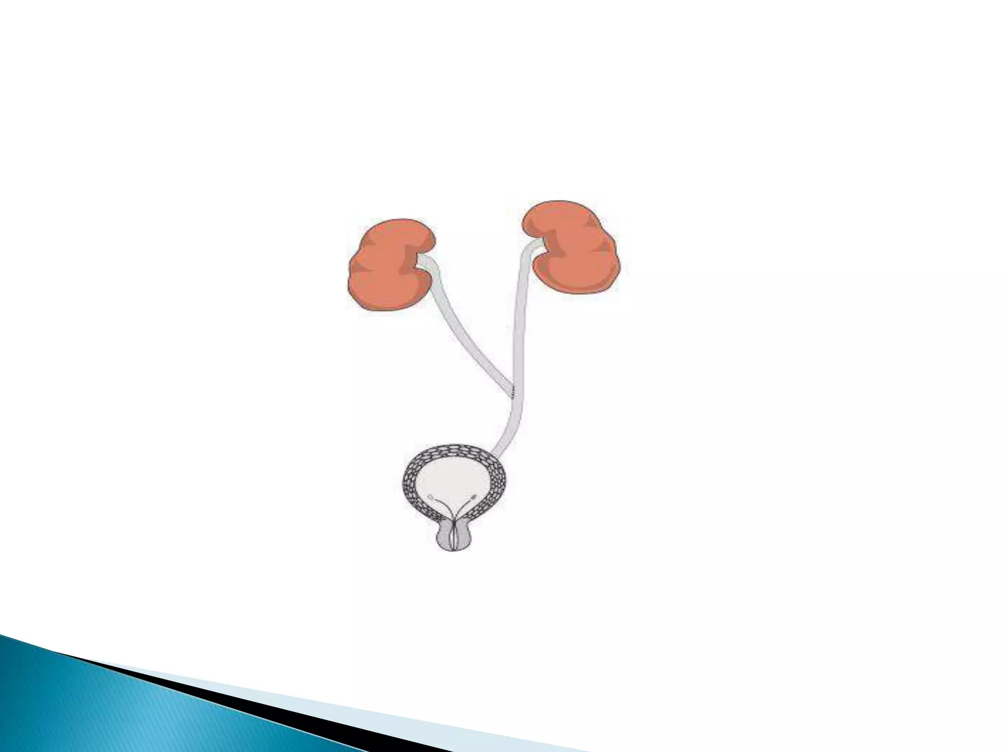 Ureteral stricture | PPTX