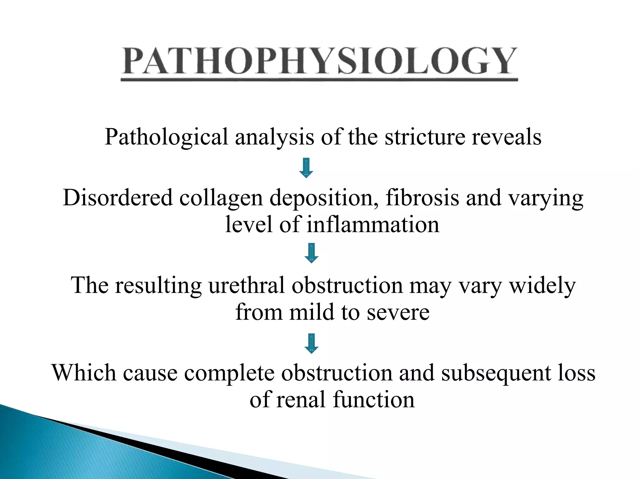 Ureteral stricture | PPTX