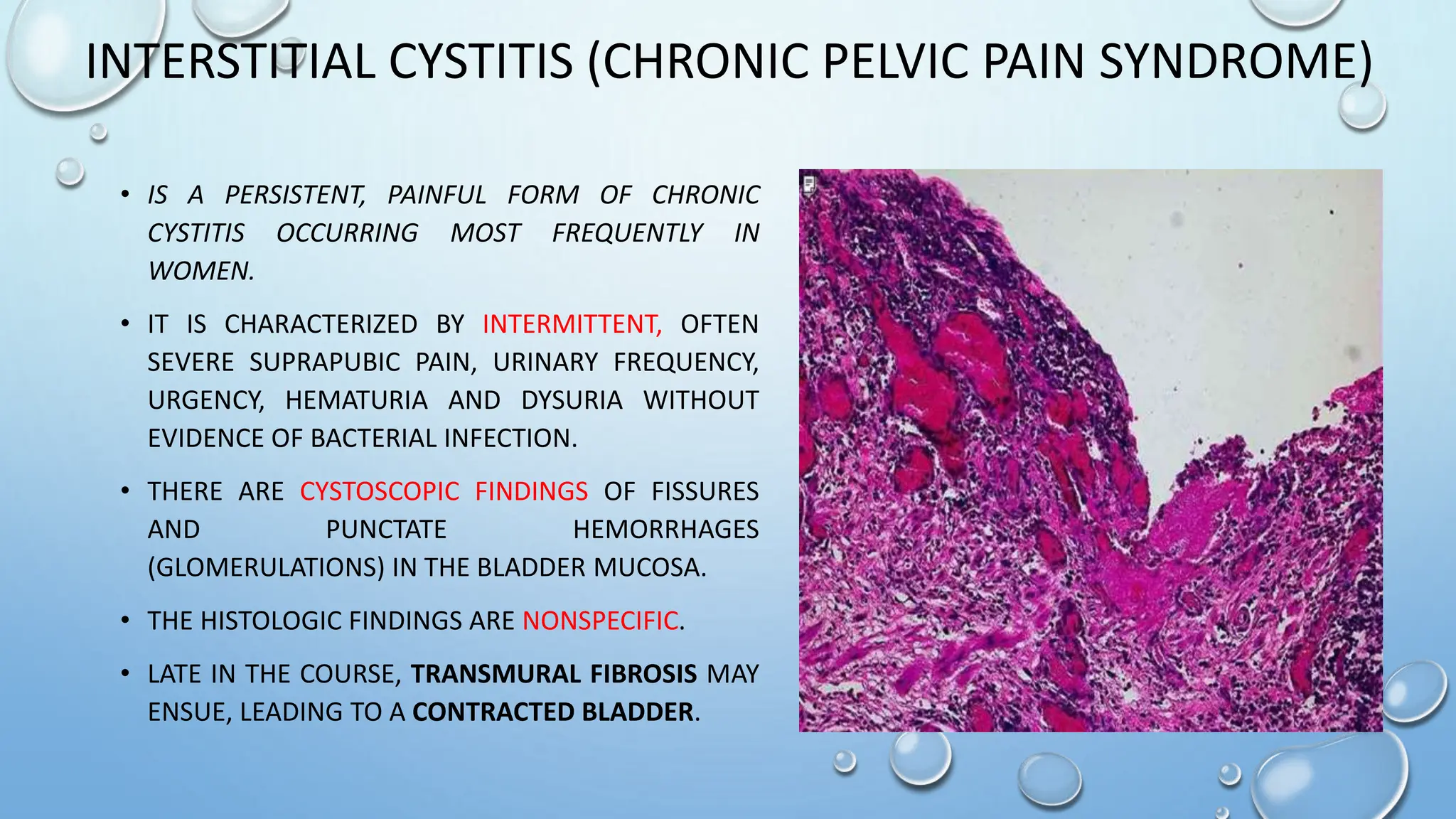Ureter pathology and urinary bladder.pptx