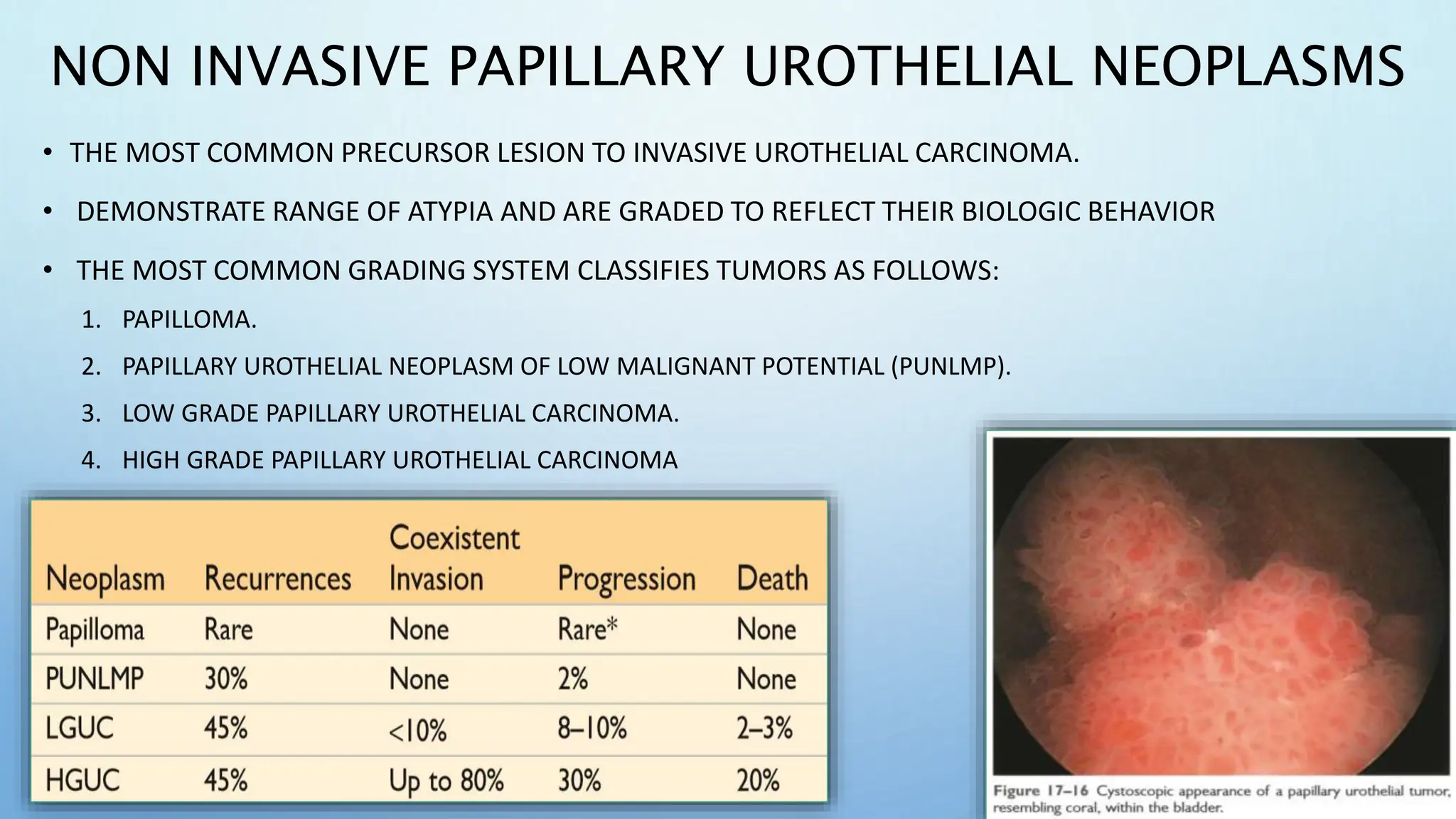 Ureter pathology and urinary bladder.pptx