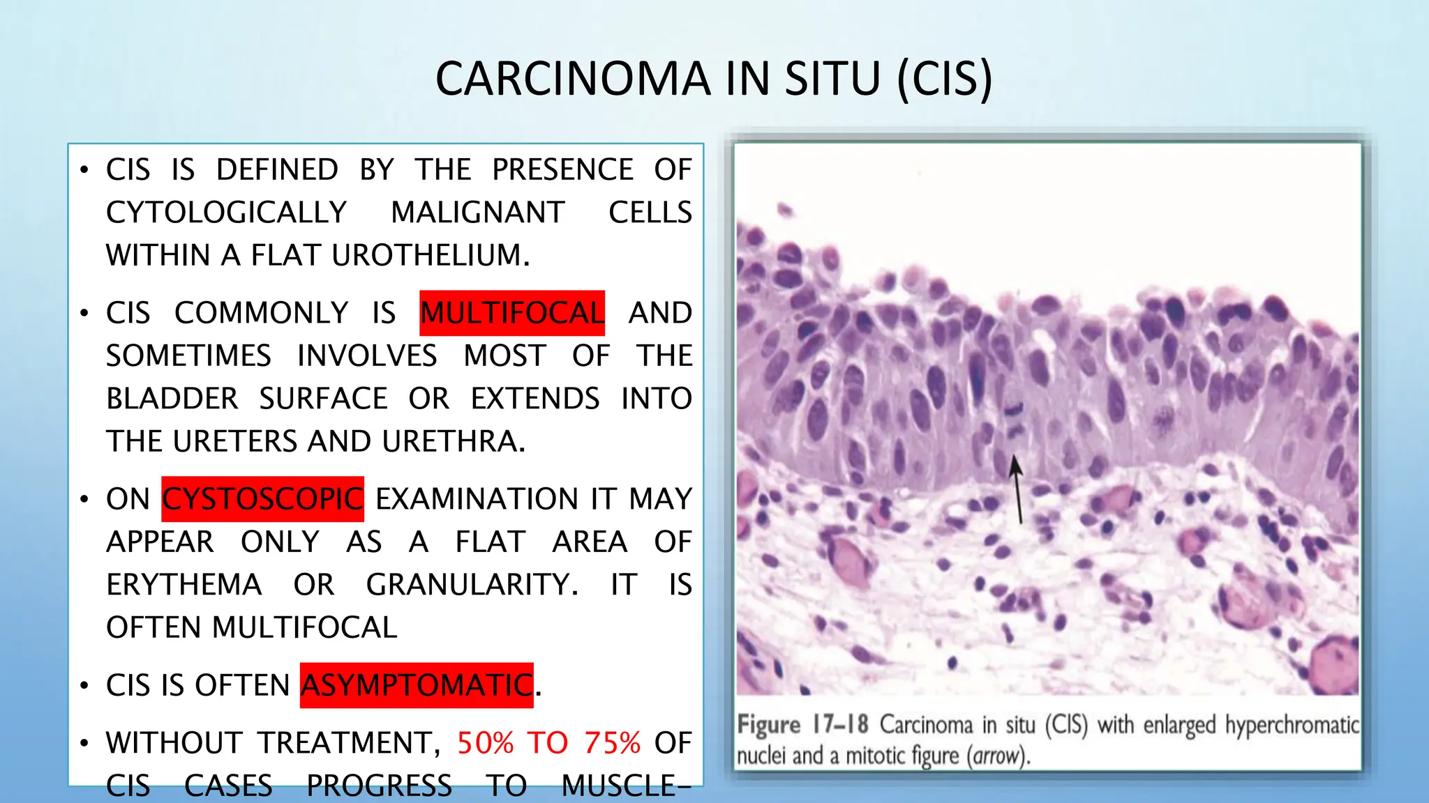 Ureter pathology and urinary bladder.pptx