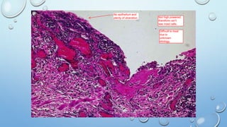 Ureter pathology and urinary bladder.pptx