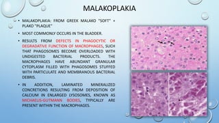 Ureter pathology and urinary bladder.pptx