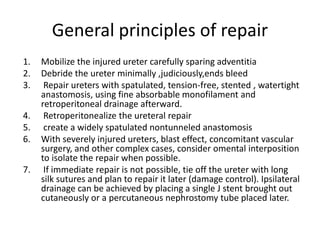 Ureteric injuries | PPTX