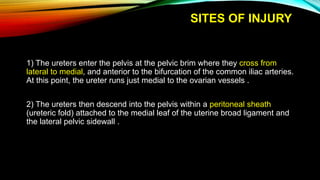 Ureteric injuries in gynecological surgeries | PPTX