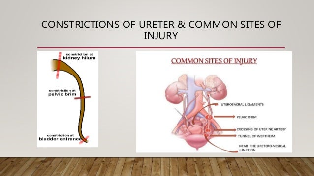 Ureteric injury