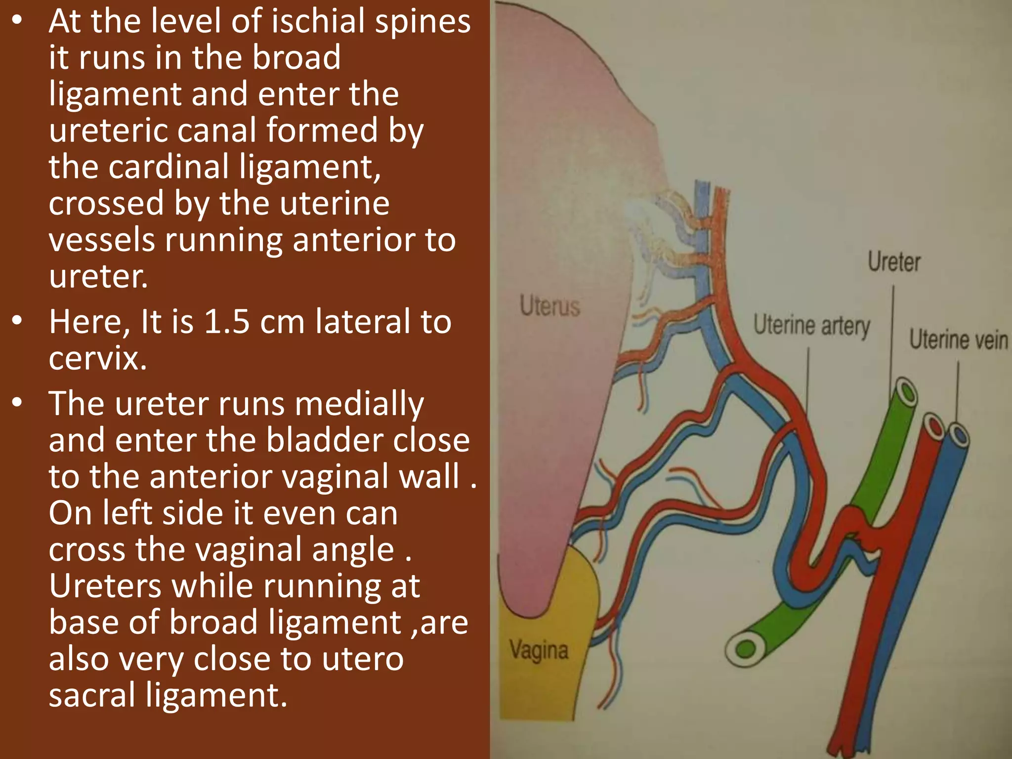 Ureteric injury in Gyenec Surgery | PPSX