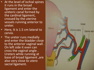 Cardinal Ligament Ureter