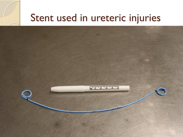 URETERIC INJURY PPT2 corrected_073603.pptx