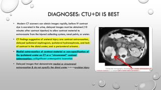 URETERIC TRAUMA. URETERIC TRAUMA. URETERIC TRAUMA.URETERIC TRAUMA ...