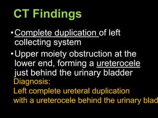 Ureterocele and Duplicated Collecting System | PPTX
