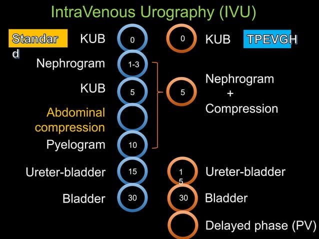 Ureterocele and Duplicated Collecting System | PPTX