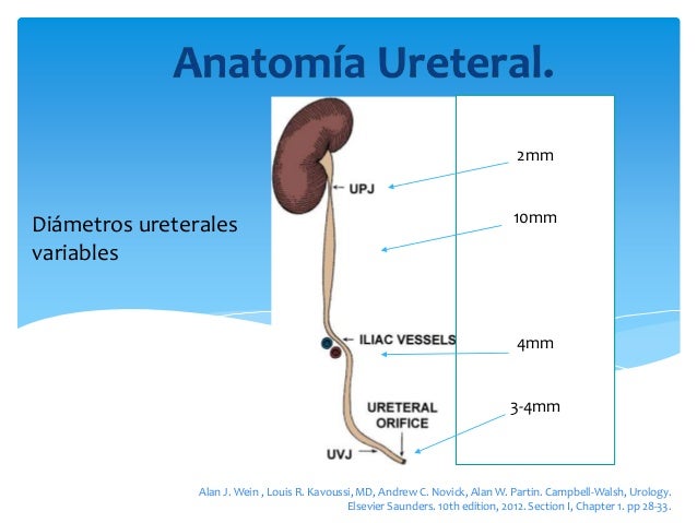 Ureteroscopia