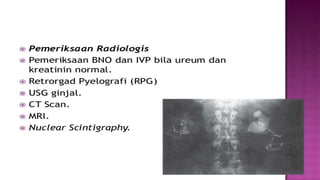 Batu saluran kemih tindakan ureteroskopi | PPTX