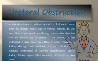 ureters disorders.pptx